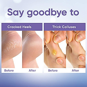 ﻿Foot Peel Mask (2 Pairs) - Foot Mask for Baby soft skin - Remove Dead Skin | Foot Spa Foot Care for women Peel Mask with Lavender and Aloe Vera Gel for Men and Women Feet Peeling Mask Exfoliating