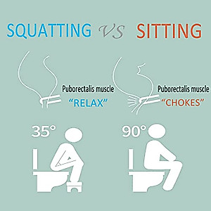 Squatting Toilet Stool,Poop Stool for Bathroom,Potty Stool for Adults,220 Lbs Capacity,Non Slip Squat Stool,7" Tall (White)