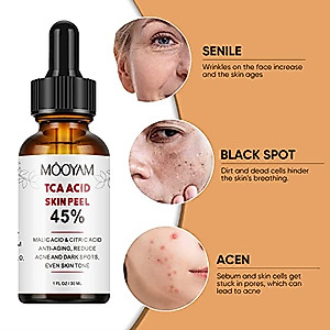 Facial Peeling Serum with 45% Citric Acid Facial Deep Exfoliating Face Chemical Peel for Acne Dark Spots Wrinkles and Fine Lines-Skin Brightening Tightening Moisturizing Serum 30 ml/1 Fl oz