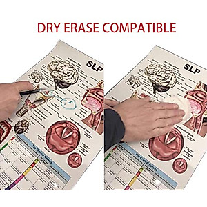 Blue Tree Publishing Larynx LP Poster, voice, education, vocal folds, mouth, head cutview, vocal pathology, size 24Wx36T