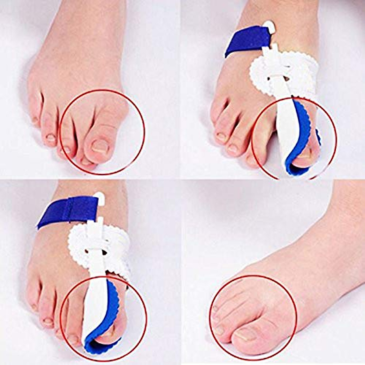 AnHua Valgus Bunion Corrector Orthotics Feet Bone Thumb Adjuster Correction Pedicure Sock Straightener Bunion Splint for Bunions For Crooked Toes Alignment Pain Relief (Style2：Blue white)