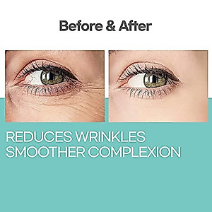 CITYGOO Caffeine Eye Cream,Eye Cream Anti Aging,Eye Cream With Collagen, Caffeine, Polypeptide - For Wrinkles, Fine Lines, Under Eye, Bags, Crows Feet Eye Lift Treatment For Men & Women…