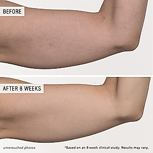 JLO BEAUTY Firm + Flaunt Targeted Booty Balm | Firms, Hydrates, Improves Skin Elasticity & Helps To Fade the Appearance of Stretch Marks | 4.2 Ounce