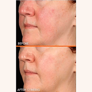 Dr Dennis Gross Vitamin C Lactic 15% Firm & Brighten Serum: Visibly Improve Signs of Aging, 1 oz