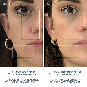 FOREO LUNA 3 Facial Cleansing Brush | Sensitive Skin | Anti Aging Face Massager | Enhances Absorption of Facial Products | For Clean & Healthy Face Care | Simple & Easy | Waterproof