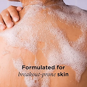 ZitSticka Body Wash - SILKSHAKE Probiotic-Rich Body Cleanser w/Tea Tree & Omega 3, 6 & 9 for Back Acne & Breakout Prone Skin, Sensitive Skin, Oily Skin, Dermatologist Tested