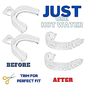 Perio-Care Gel for Trays (5 Tubes + Trays) - 1.7% Hydrogen Peroxide Gel - Designed to Treat Bleeding Gums, Gingivitis, Periodontitis, Periodontal Disease and Gum Disease