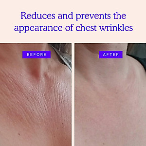 Chest Wrinkle Pads - Silicone Patches for Wrinkles - Overnight Anti Wrinkle Patches, Anti Aging Silicone Wrinkle Patches Reusable - Neck & Décolleté, Skin Safe Chest Wrinkle Patches (1-mo Supply)