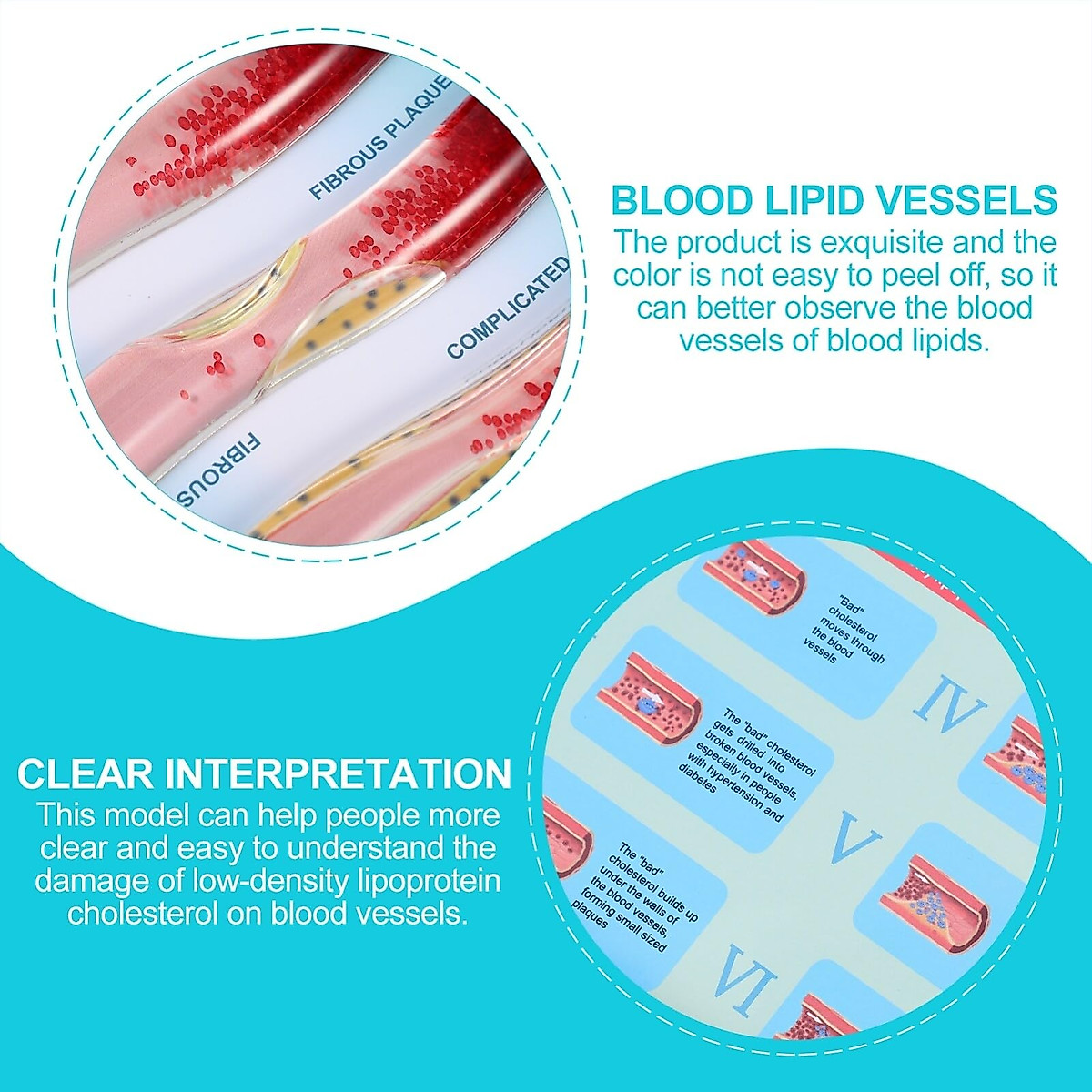 Human Body Skeleton Anatomical Model Low- Density Lipoprotein Blood Vessel Model