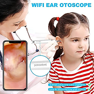 Pancellent Digital Otoscope Camera with Light, Ear Camera and Wax Remover, Video Ear Scope with Ear Wax Removal Tools, Compatible with iPhone, iPad, Android Smart Phone (Basic Edition White)