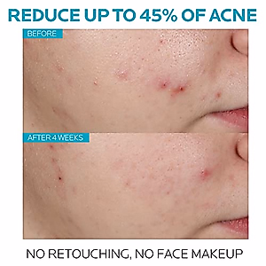 La Roche Posay Effaclar Salicylic Acid Acne Treatment to Minimize Pores, Clear Acne Blemishes and Post Acne Marks