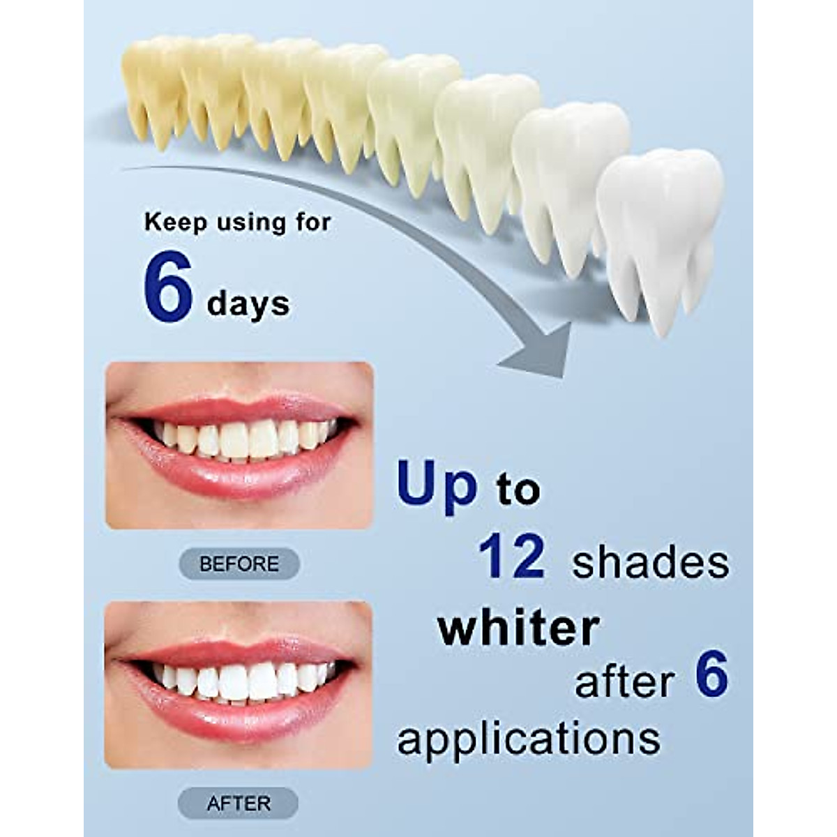 MySmile Teeth Whitening Kit with LED Light, 3 Non-Sensitive Teeth Whitening Gel and Tray, Deluxe 10 Min Fast-Result Carbamide Peroxide Teeth Whitener, Help Remove Teeth Stain from Coffee
