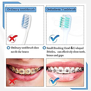 6 Pieces Brace Toothbrush V Shaped Orthodontic Toothbrush with Brush Head 40 Pieces Interdental Brush Soft Bristle Braces Brushes for Cleaning Portable Toothbrushes for Braces (Orange,Medium)