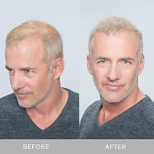 XFusion Keratin Hair Fibers - Medium Brown (3g Travel Size)