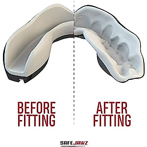 SafeJawz Sports Mouthguard Dual Layer Premium Protection Adults and Junior Gum Shield with Case for Boxing, MMA, Rugby, Martial Arts, Judo and All Contact Sports