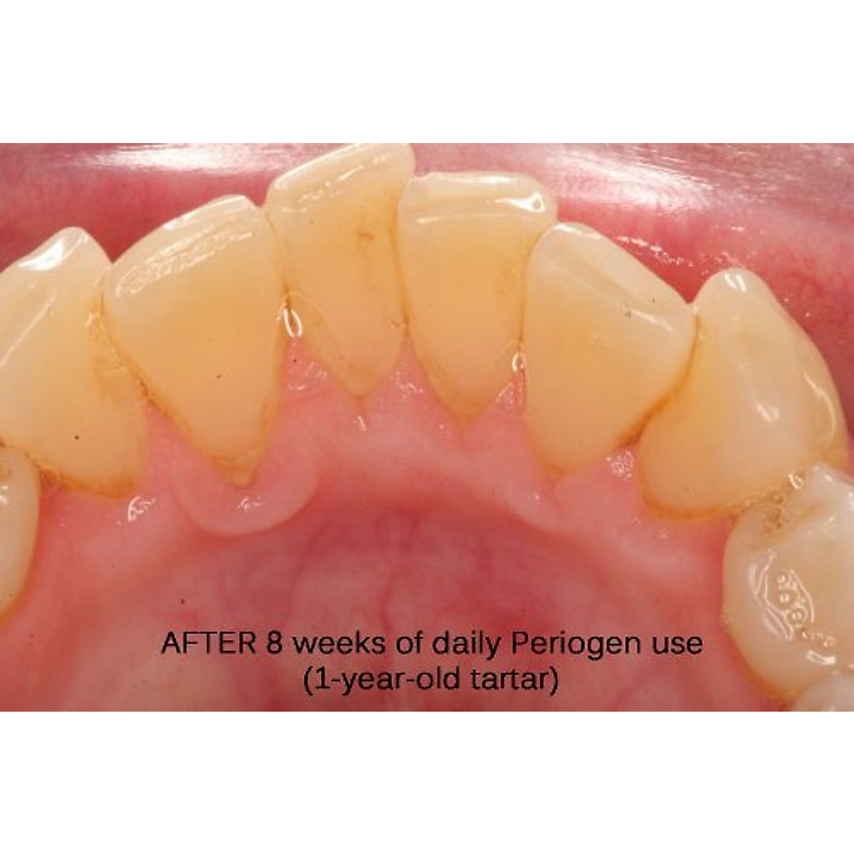 Periogen Complete Oral Health Rinse (3-PK)