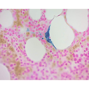 Iron (Prussian Blue) Stain Pack, 1000ml