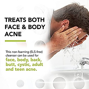 humane Regular-Strength Acne Wash - 5% Benzoyl Peroxide Acne Treatment for Face, Skin, Butt, Back and Body - 8 Fl Oz - Dermatologist-Tested Non-Foaming Cleanser - Vegan, Cruelty-Free