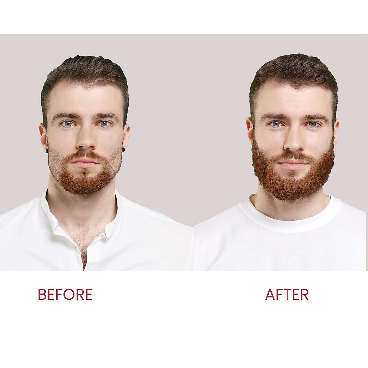 TOMUM Biotin Hair Growth Shampoo for Men and Women - Treatment for Thinning Hair and Hair Loss - Biotin,Caffeine & Saw Palmetto Enriched Formula for Hair Thickening and Regrowth DHT Blocker 13.5 FlOz