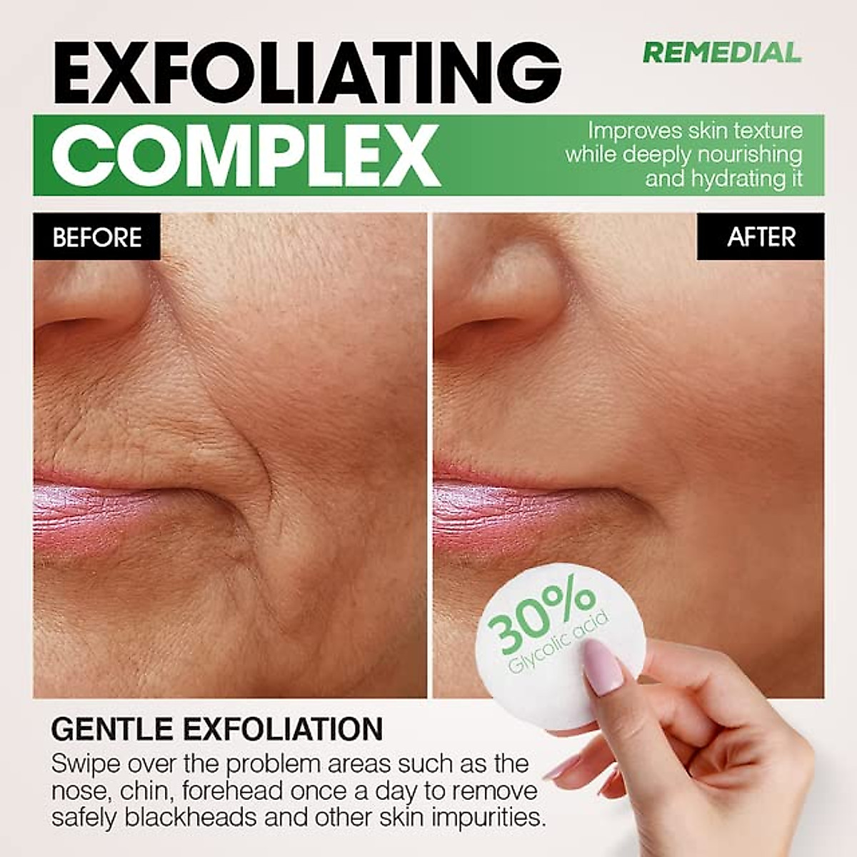 Glycolic Acid Resurfacing Pads for Face and Body - 30% Exfoliating Facial Peel - Vitamins B5 C E, Green Tea - Glycolic Acid Face Wash – 60 Pre-Moistened Cotton Pads for Face Cleansing and Peeling