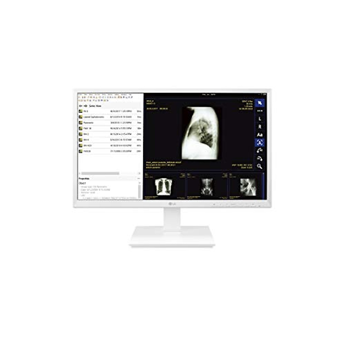LG 24” 24CK560N-3A All-in-One FHD IPS Thin Client for Medical & Healthcare with Fanless & Ergonomic Design