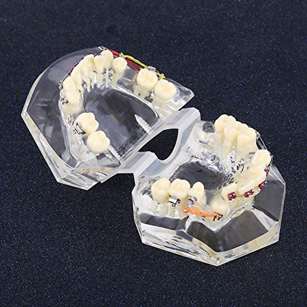 Teeth Educational Model Dental Treatment Malocclusion Study Demonstration Teeth Model with Wire Chain Orange