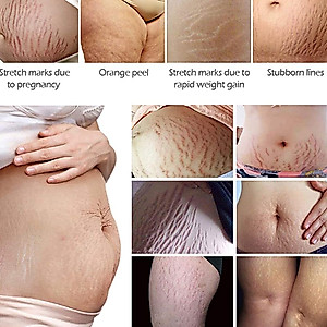 Hotiary Maternity Stretch Mark 7 Days Repair Cream Removing Tatoo Molding Non-marking Pregnancy Obesity Skin Postpartum Stretch Scar Body Marks Remover Smooth Skin Care 1.67 oz