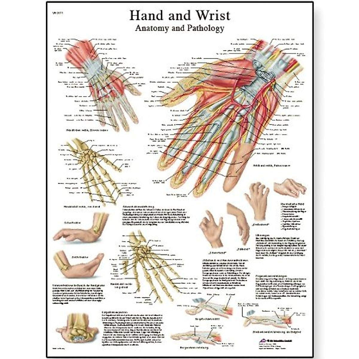 3B Scientific VR1171L Glossy Laminated Paper Hand and Wrist Anatomy and Pathology Chart, Poster Size 20" Width x 26" Height