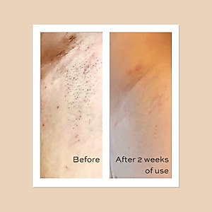 Hygiene Hero Exfoliating Cranberry & Daily Ritual Oatmeal Private Bar Soap 3.25 oz / 92 g - Face & Body Wash for Dark Spots, Intimate Areas, Underarms - Set of 2