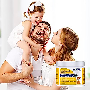 OHEAL Manuka Honey Eczema Cream, Eczema Psoriasis Shingles Honey Cream for Dry Skin, One Bottle for Dermatitis Cream, Psoriasis Treatment for Skin, Eczema Honey for Ringworm Treatment, 3.4 oz