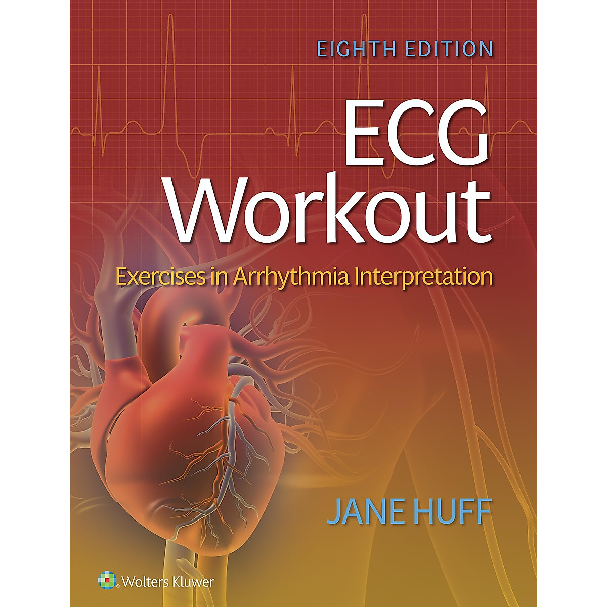 ECG Workout: Exercises in Arrhythmia Interpretation