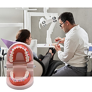 Angzhili 1 Piece Dental Demonstration Orthodontic Model with Metal Wires and Bracket (Ceramic bracket)