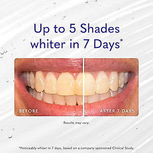 Smileactives Teeth Whitening Gel for Toothpaste with Clinical-Grade Hydrogen Peroxide, Tooth Stain Remover for White Teeth, Dentist Quality Pro Whitening Gel to Remove Stains, 90 Day, 3.8 oz Bottle