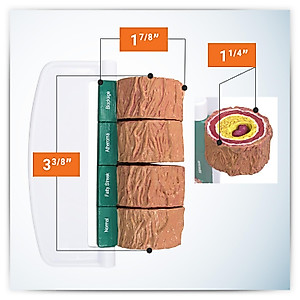 4-Piece Artery Model | Human Body Anatomy Replica of Artery w/Plaque Build Up for Doctors Office Educational Tool | GPI Anatomicals