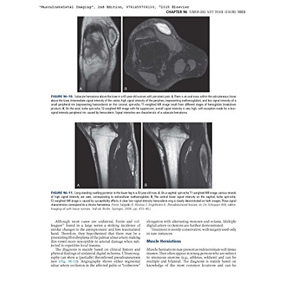 Musculoskeletal Imaging: Expert Radiology Series