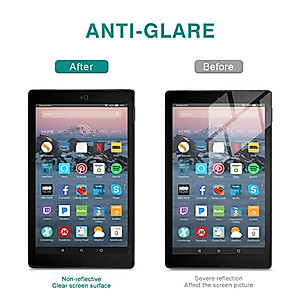 ZOEGAA Anti-Blue Light Screen Protector for Amazon Fire HD 10 Tablet 10.1" (7th / 9th Generation, 2017/2019 Release) and Fire HD 10 Kids Edition, (Not for 11th Generation 2021 Release) PET Film