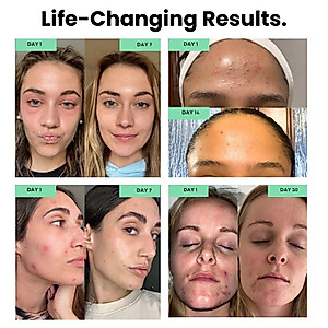 Filterbaby 1.0 Faucet -Mounted Water Filter for Skin Care - Hydrate & Brighten Skin While it Cleans - Fits Most Standard US Faucets - Three Settings (White)