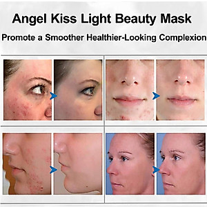 Angel Kiss Light Beauty Mask - Led Face Mask Light Therapy - Red Light Therapy Mask for Face - LED Facial Skin Care Mask
