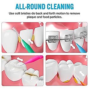 DGDFLDGC 120 Pcs Interdental Brushes for Cleaner Dental Tools, Braces Kit Braces Toothbrush Braces Care Tooth Cleaning Tool, Tooth Flossing Head Oral Dental Hygiene Brush