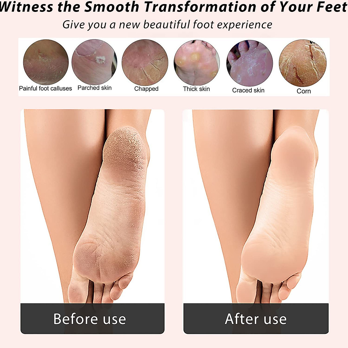 ICANdOIT Natural Brown Earth Lava Pumice Stone, Pedicure Exfoliation Tool,Callus Remover for Feet Heels and Palm,Corn Remover,Dry Dead Skin Scrubber,Health Foot Care,Dry&Wet Use,Pack of 1