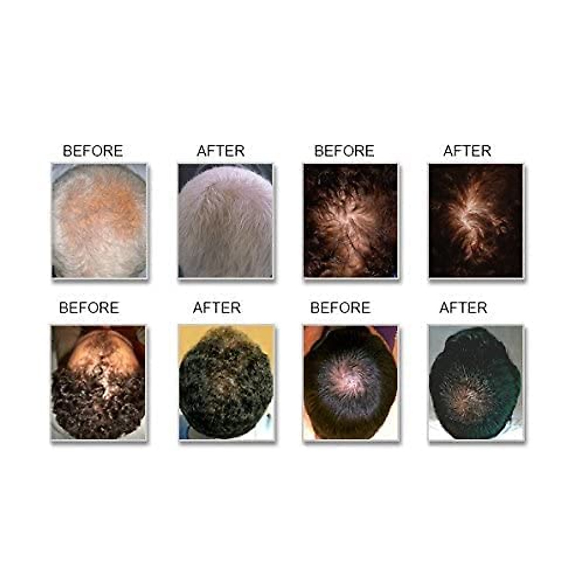 Revivogen PRO Thickening Conditioner,8 Fl Oz