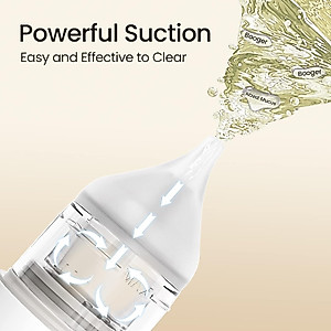 Hopebig Nasal Aspirator Baby Nose Sucker, Electric Baby Nose Sucker with Adjustable 3 Levels Suction & 2 Size Nozzles with Music & Light Soothing Function for Toddler