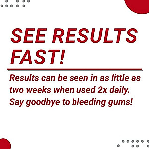 Perio-Care Gel for Trays (5 Tubes + Trays) - 1.7% Hydrogen Peroxide Gel - Designed to Treat Bleeding Gums, Gingivitis, Periodontitis, Periodontal Disease and Gum Disease