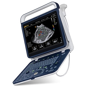 BPU60V Hand-Carried 15" Color Doppler Ultrasound System equine, large animal, small animal, zoo mammal, and marine mammal medicine body scans Abdomen, Reproduction, Gynecology, Cardiology, Small Parts