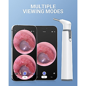 ScopeAround Wireless Otoscope with Light Ear Camera, 3.9mm Ear Wax Removal Tool Camera, 720P HD with 6 LED Lights, WiFi Wireless Otoscope Camera, Ear Scope Compatible with Android and iPhone