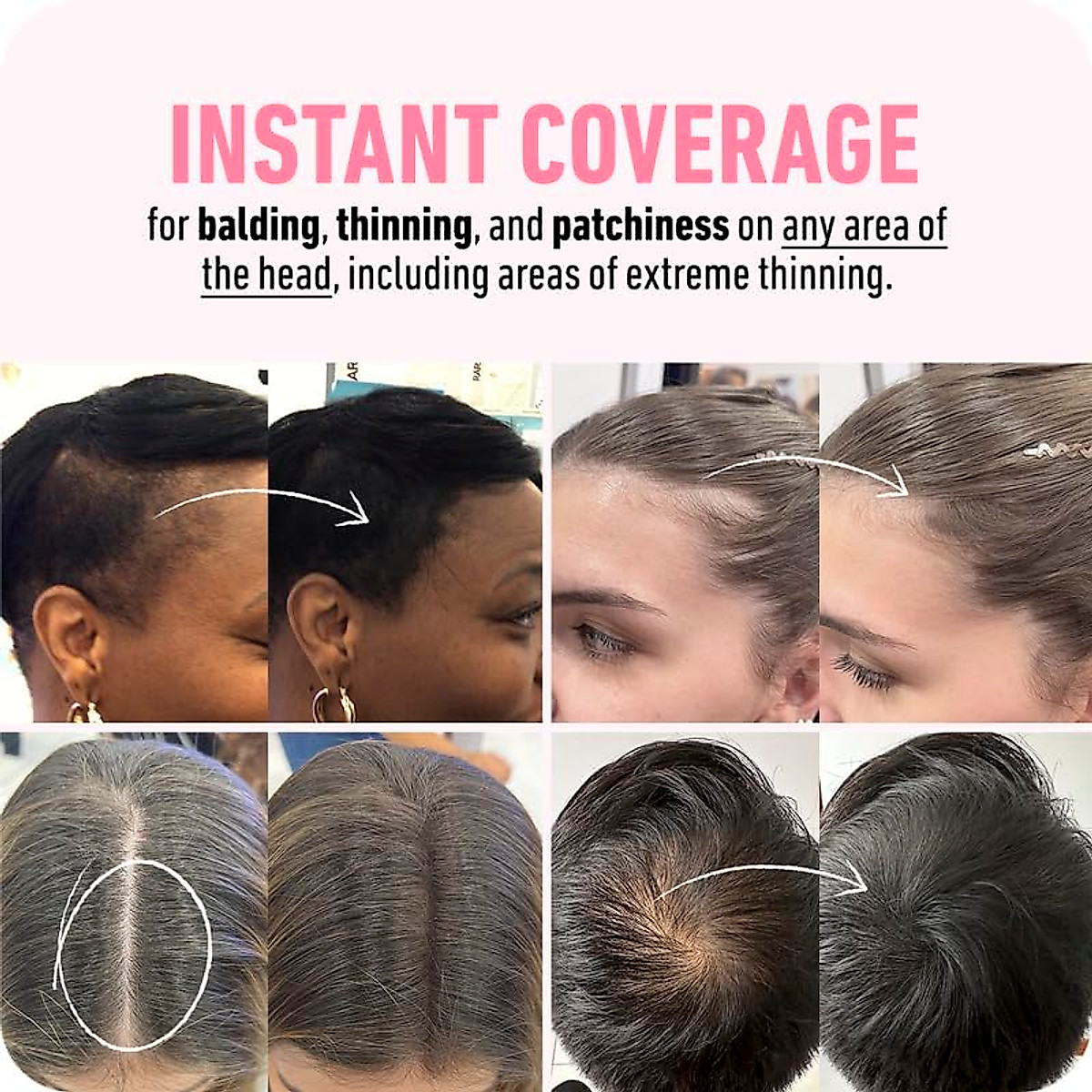 BOLDIFY Hairline Powder - Root Touch Up Hair Color for Gray Coverage - Bald Spot Concealing Hair Powder for Women & Men - 48-Hour Stain-Proof - Dark Brown