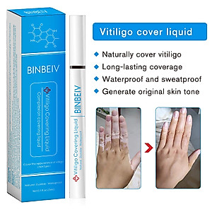 BINBEIV Vitiligo Cosmetic Camouflage Liqui, Cover appearance of Skin Depigmentation, Natural-Durable-Waterproof, Makeup Cover Waterproof, Used on face, hands and body