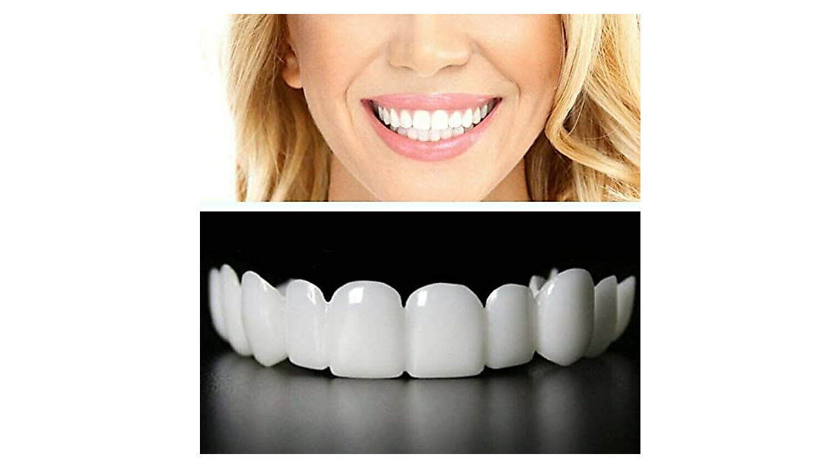 Adjustable Veneers for Confident Smiles | 2 Pairs