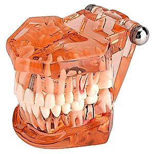 Maxmartt Teeth Model, Dental Demonstration Dental Implant Removable Study Model Teeth Teaching Model for Student Teacher, Orange