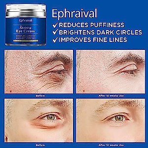 Ephraival Men's Eye Cream, Eye Cream for Dark Circles and Puffiness, Anti-aging Caffeine Eye Cream for Men, Brightens, Reduces Puffiness, Dark Circles, and Fine Lines, Eye Treatment for Men Women